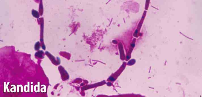 Vse o kandidi in drugih glivicah - Med.Over.Net