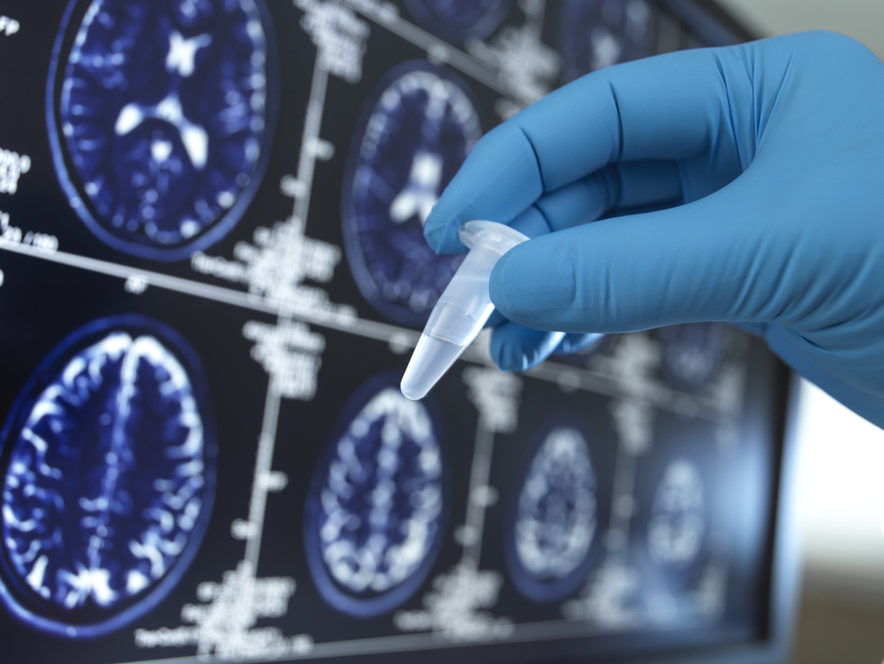 Ta na videz nedolžen virus lahko povzroči resne zaplete - Med.Over.Net