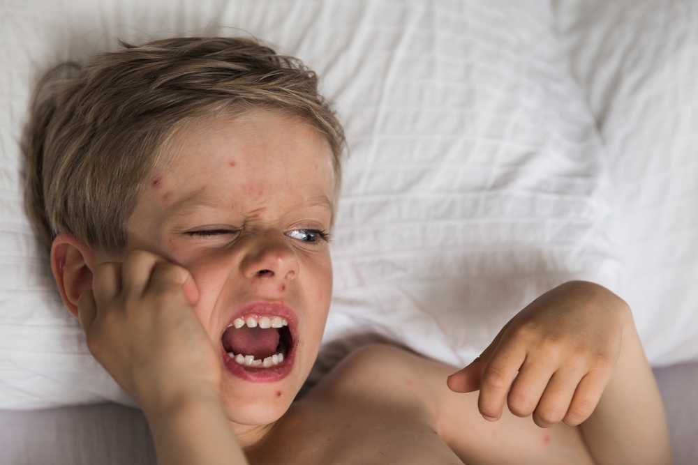 Norice poleti: mi planiramo morje, otrok ima pa norice. Nočna mora ...