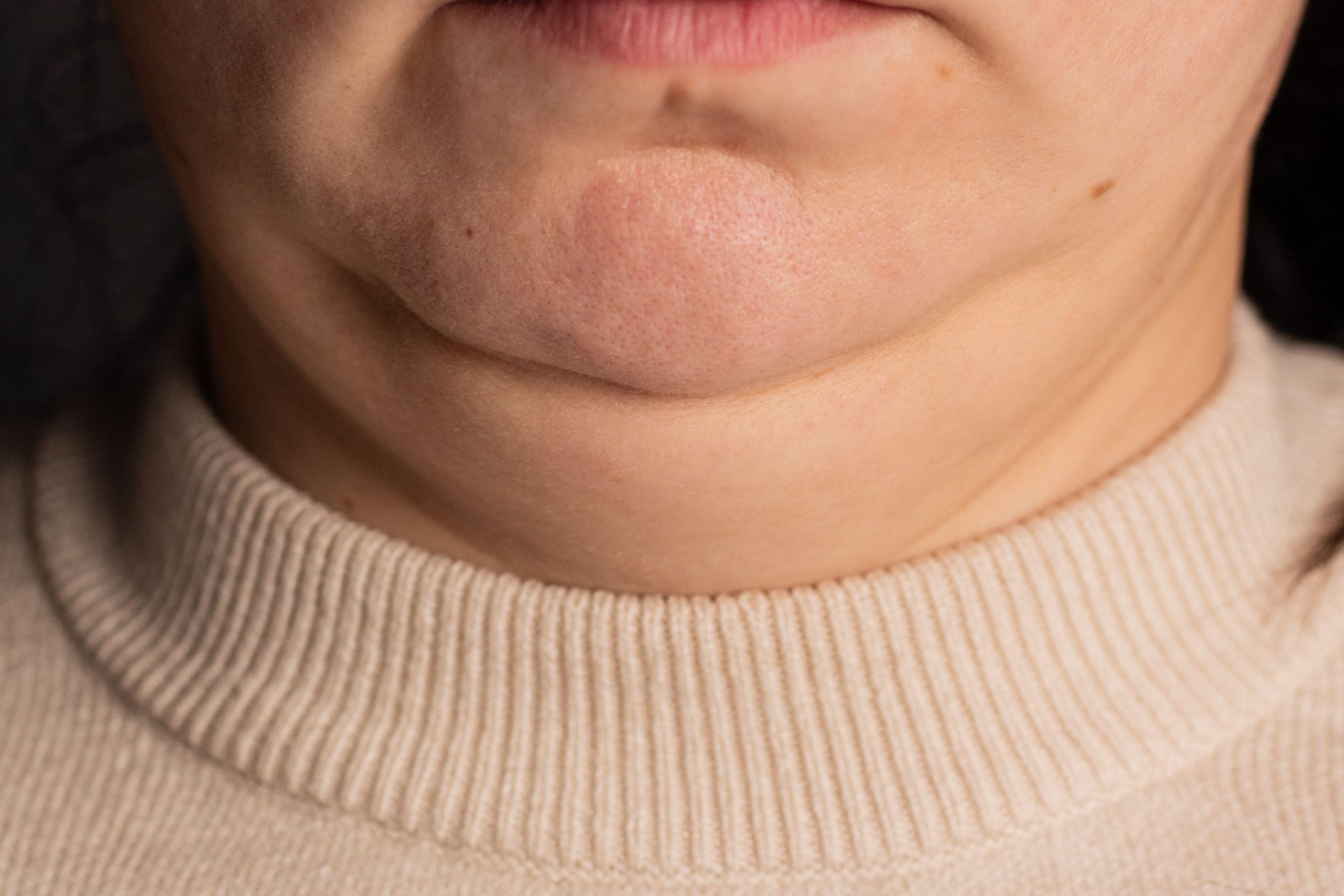 Kaj obseg vratu razkriva o vašem zdravju